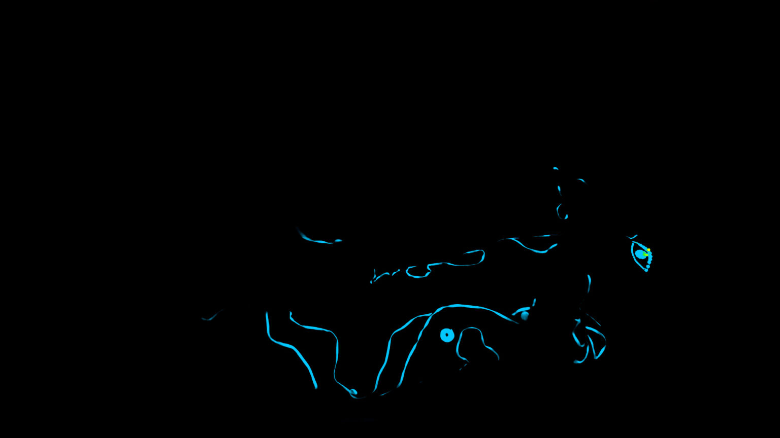 Morphai – Yiou Wang